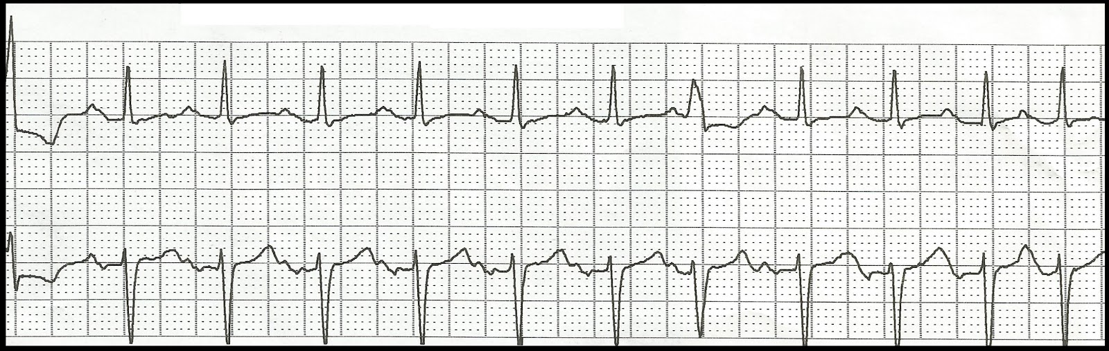Practice EKG Rhythm Strips 154