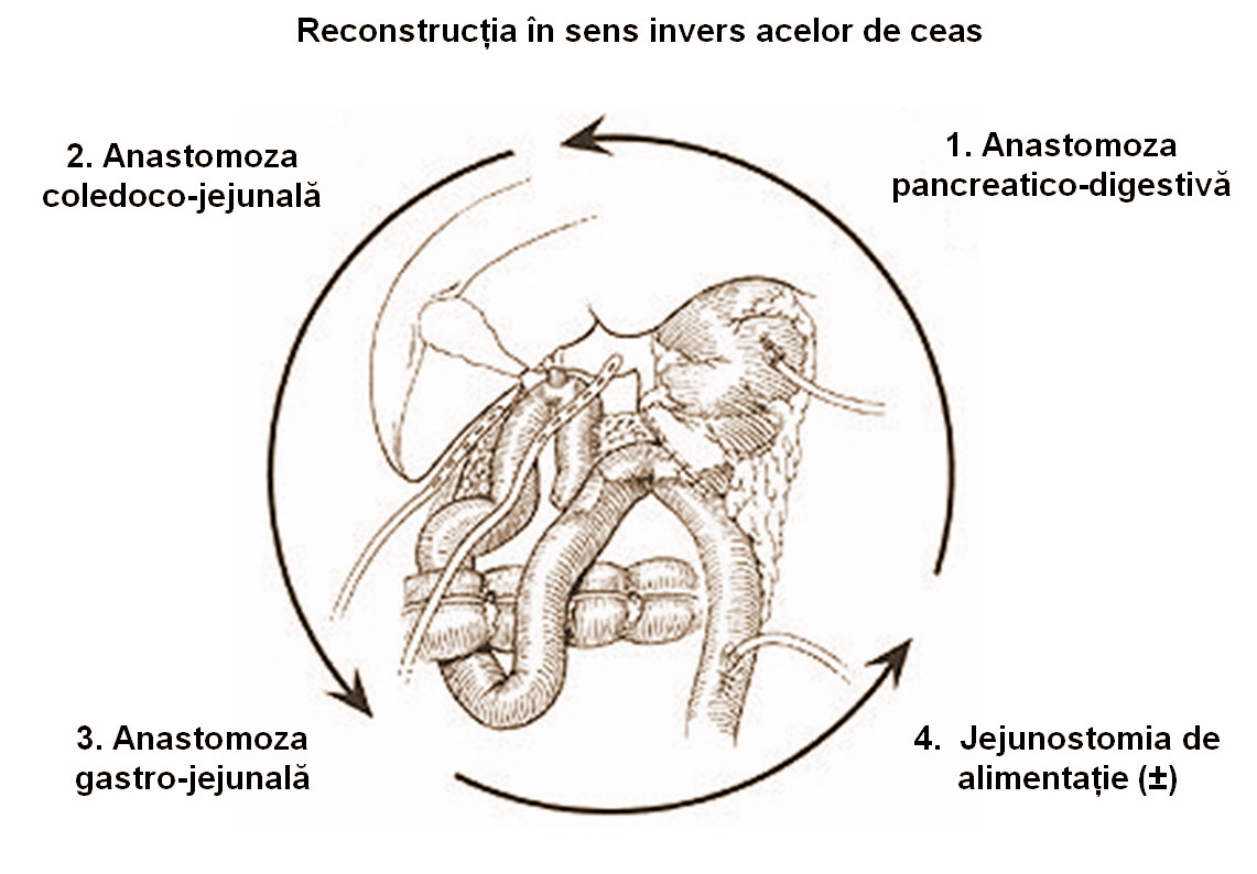 jejunostomia - wood scribd braxin