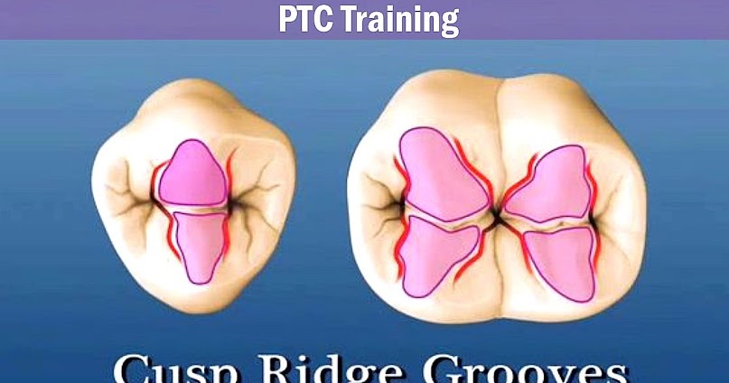 COURSE: Simplifying Posterior Dental Anatomy - PTC Training - Odonto-Tv