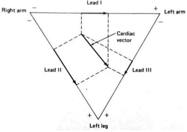 ECG Measurement System ~ Electronics and Communication