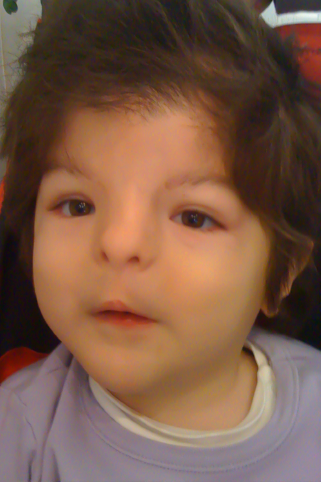 El blog de Budy (el golfo): SEMANA DEL SINDROME OROFACIODIGITAL TIPO 1