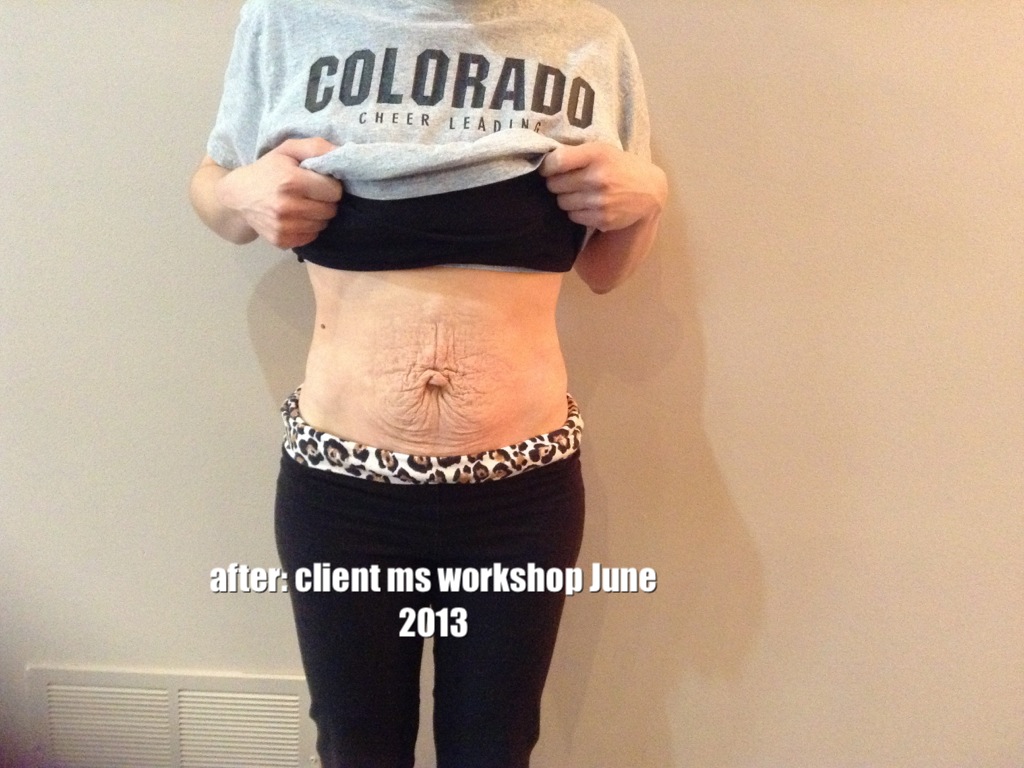 More Amazing results post workshop – Crazy pictures, Hernias reversed ...