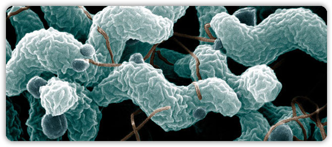 microbiology: Food infections (Campylobacter jejuni)