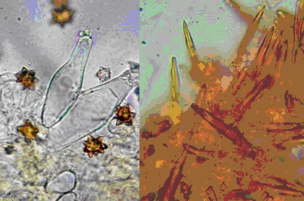 FUNGOS DE GALLAECIA Y NORTE DE LUSITANIA: MICROSCOPIA DE SETAS