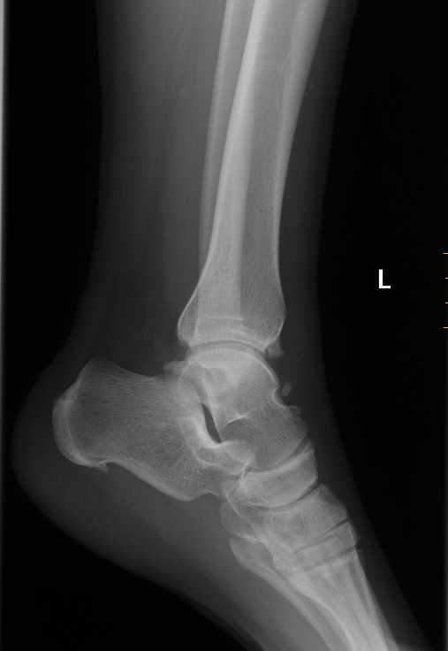 Fanáticos del pie: mayo 2012