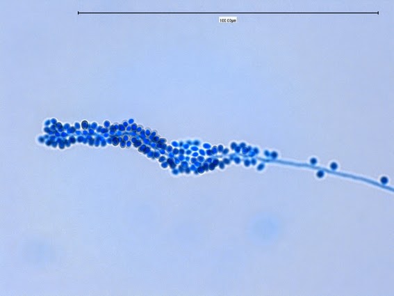 Fun With Microbiology (What's Buggin' You?): Sporothrix schenckii ...