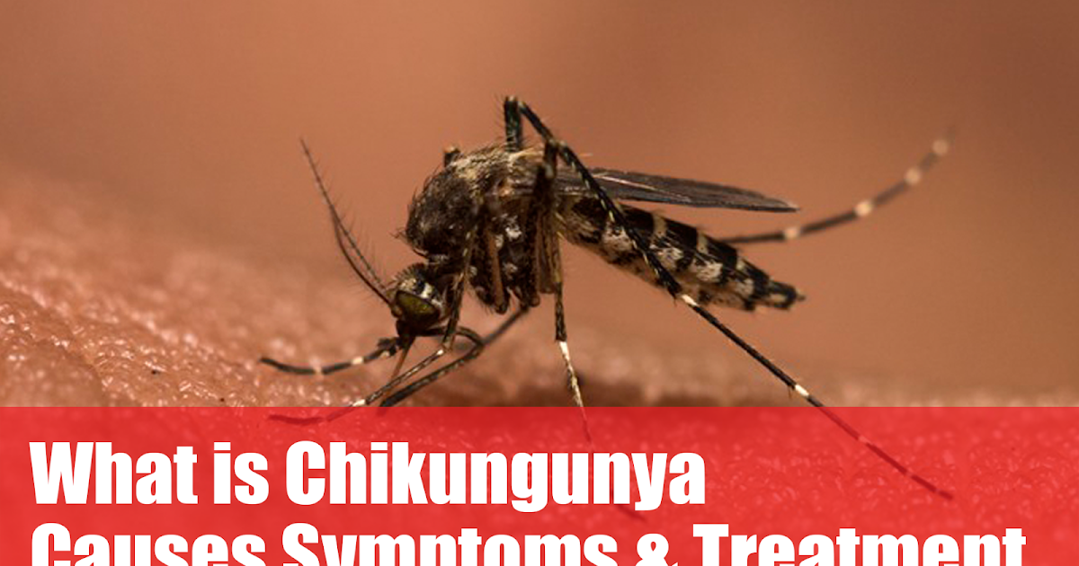 What is Chikungunya Causes Symptoms and Treatment ~ World News Trends