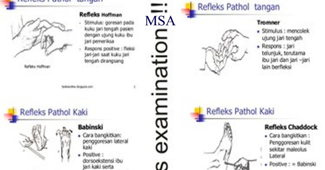 Pemeriksaan Klinis Neurologi: refleks patologis