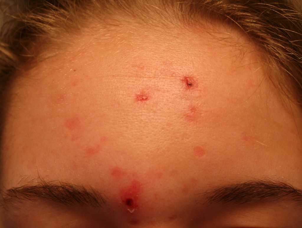 Learners Desk: About Photoshop Spot Healing Brush Tool