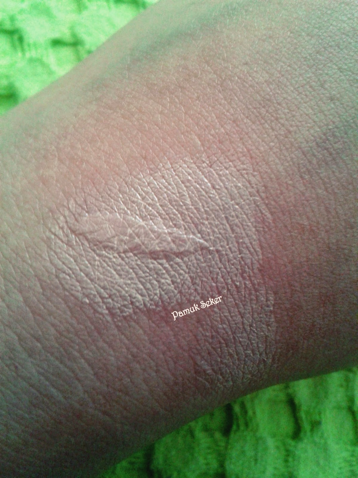 Imex Sivilce Kremi - Pamuk Sekeer: Günlük