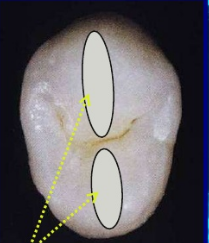 morfologia dental : morfologia