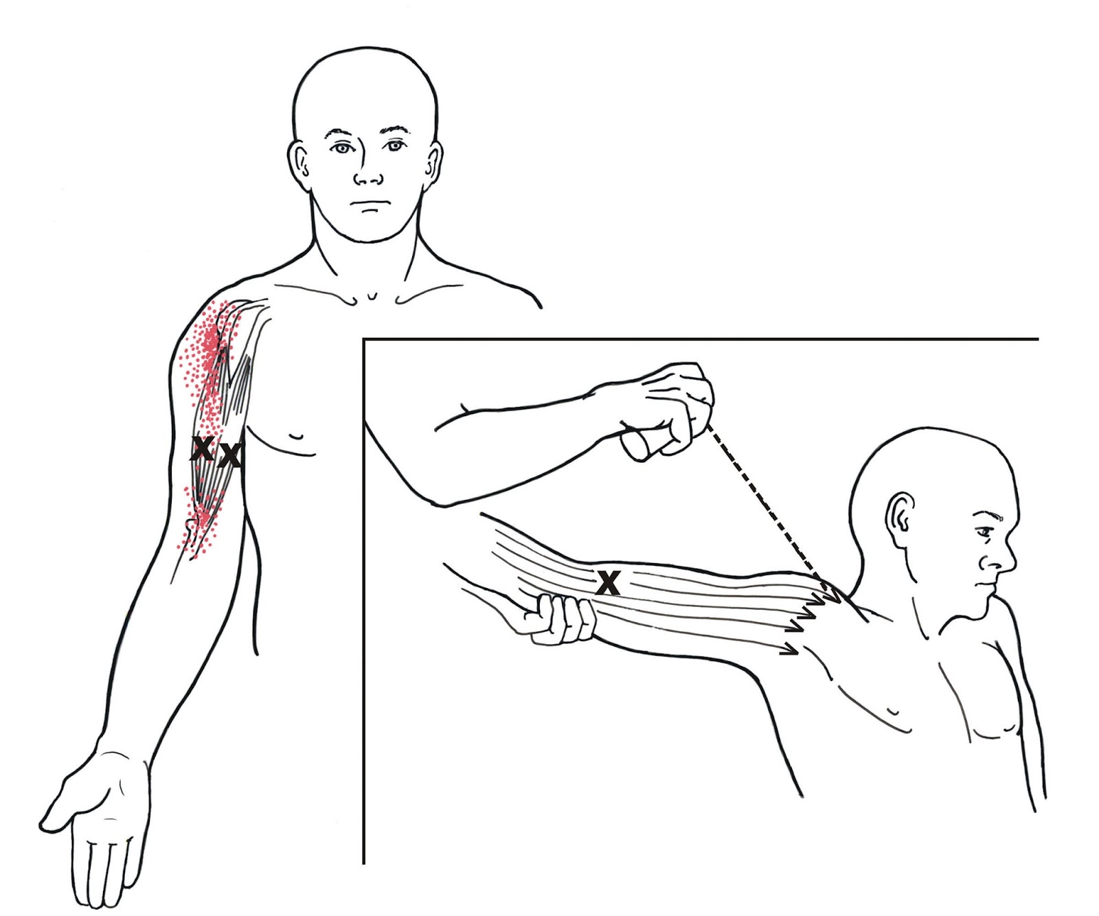 Christian Pain Management Blog - Pittsburgh: Spray and Stretch