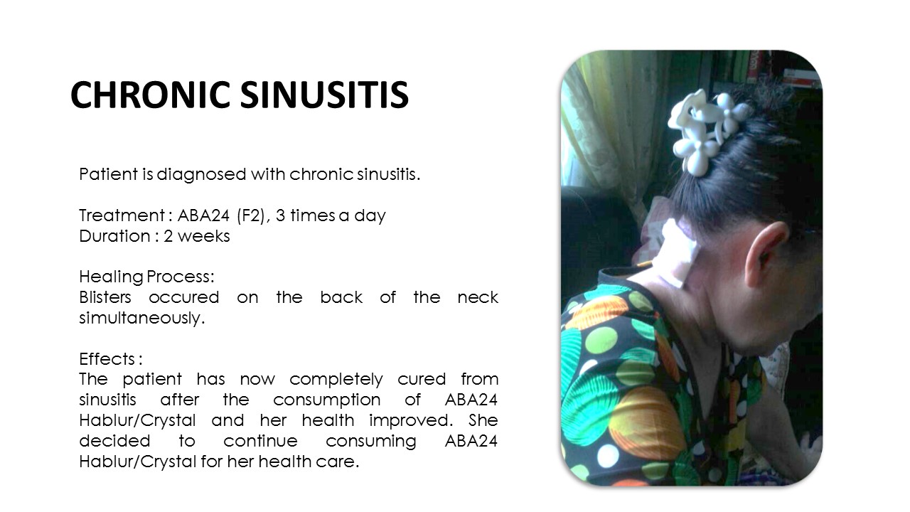 ABA24 HABLUR/ CRYSTALS (WONDERS OF THE WORLD): Testimonies of ABA24 ...