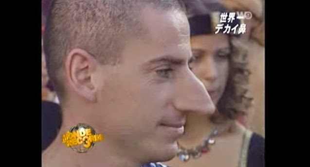 El mas narizon del mundo | Historias increibles