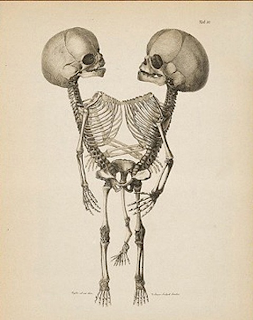 The Body Blog: Disfigured...