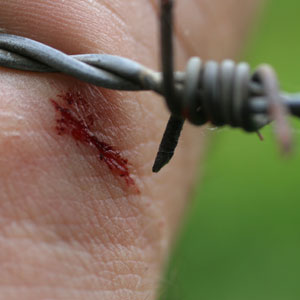 Health And Diseases Blog: Tetanus