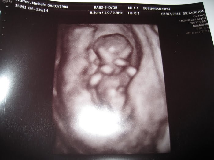 the prathers: 14 weeks: baby bump has arrived