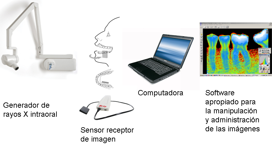 LOS RAYOS X EN LA ESTOMATOLOGIA: ¿QUE ES LA IMAGENOLOGIA DIGITAL?