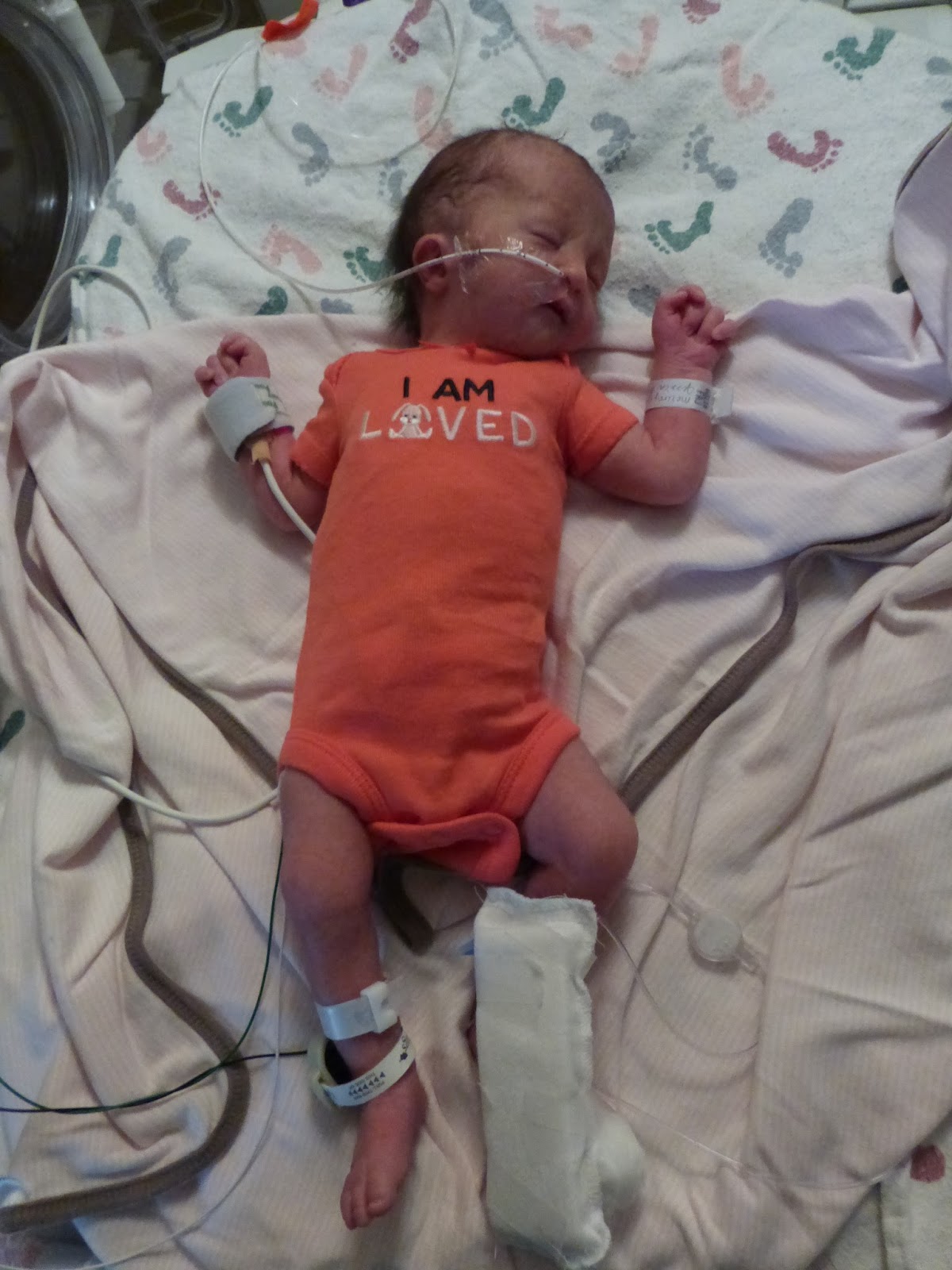 Cherishing Elise: Carrying and Loving Our Trisomy 18 Baby