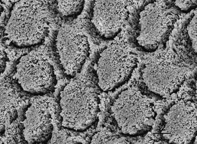 Dentosphere : World of Dentistry: Mechanism of Bonding agents and Bond ...