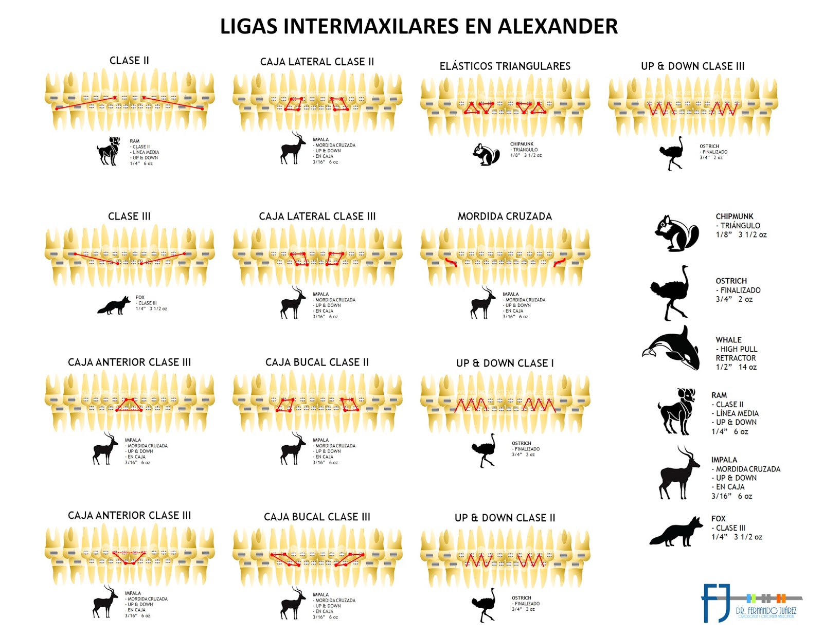 Elásticos Intermaxilares en la técnica de Alexander (póster aporte ...