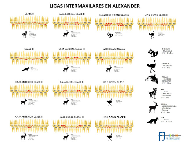 Elásticos Intermaxilares en la técnica de Alexander (póster aporte ...