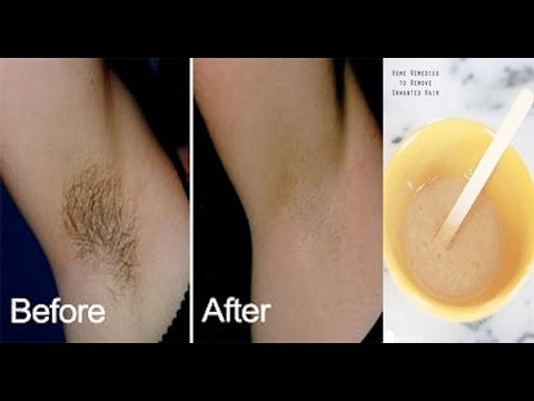 Tips y reflexiones para la vida: COMO QUITARSE LOS VELLOS DE LAS AXILAS ...