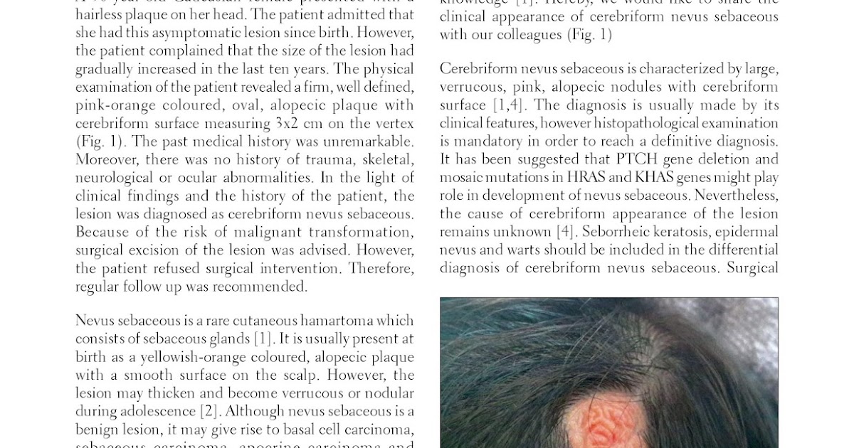 MEHMET EREN YUKSEL: Cerebriform nevus sebaceous
