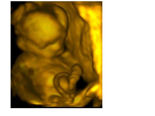 First Choice Baby Scan: 17 weeks pregnant - Gender Scan