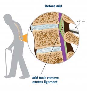 News Center: Franciscan Health - Indianapolis, Carmel, Mooresville ...