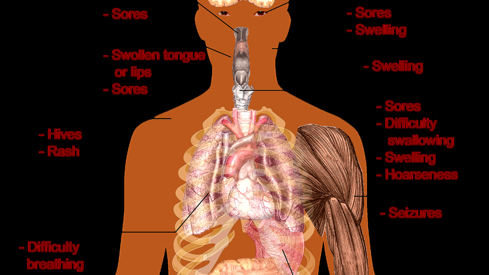 Morphine Morphine Side Effects Effect Choices morphine-morphine-side-effects-effect-choices