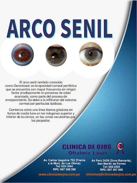 Clínica de Ojos Oftalmic Láser: ARCO SENIL