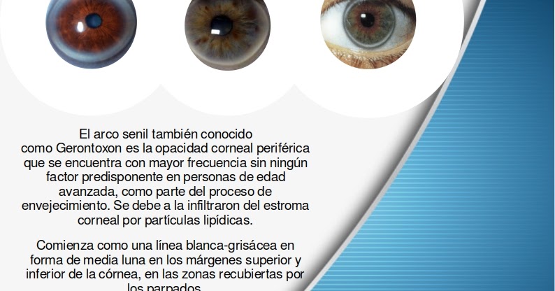 Clínica de Ojos Oftalmic Láser: ARCO SENIL