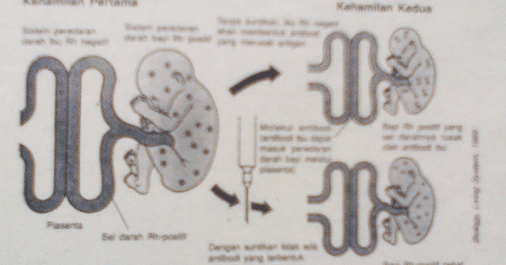 Penggolongan Darah Sistem - Rh (Golongan Darah) - Biologisites