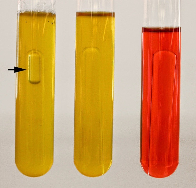 Laporan Praktikum Mikrobiologi Umum Identifikasi Bakteri Melalui Uji ...