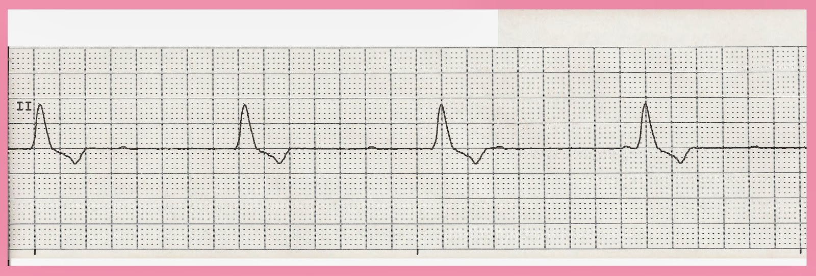 Practice EKG Rhythm Strips 209