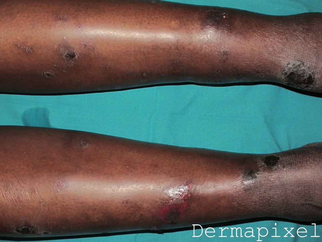 Dermapixel: mayo 2013