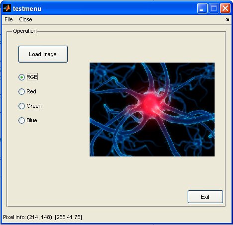 Image Processing & Science Applications: Simple GUI in MATLAB guide