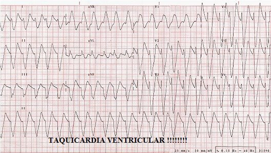 Dr. Rafael Soto - Electrocardiografía - Cardiología clínica ...