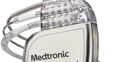 Medtronic’s CRT-Ds Now Approved for 3 Tesla Scanning in Europe ~ OUR ...