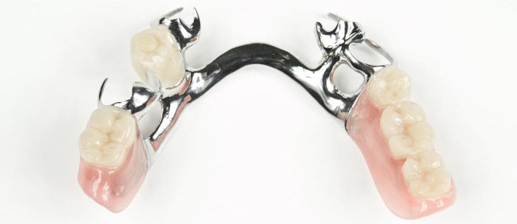 Prótese dentária - Dentista Leandro Prado