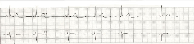 EKG Rhythm Strip Quiz 7