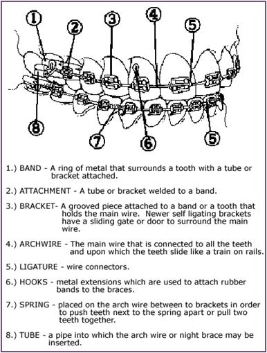 Dentistry lectures for MFDS/MJDF/NBDE/ORE: AN ORTHODONTIC LECTURE NOTE ...