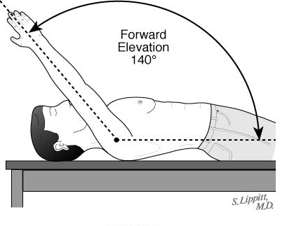 UW Shoulder and Elbow Academy: Is the shoulder stiff?