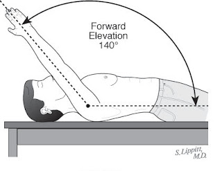 UW Shoulder and Elbow Academy: Stiff shoulder, painful shoulder, frozen ...