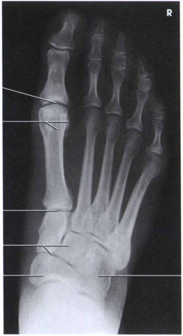 Gudang Medis: teknik radiografi pedis