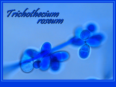 Fun With Microbiology (What's Buggin' You?): Trichothecium roseum