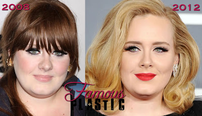 Adele Plastic Surgery Nose Job Before and After (Star plastic surgery)
