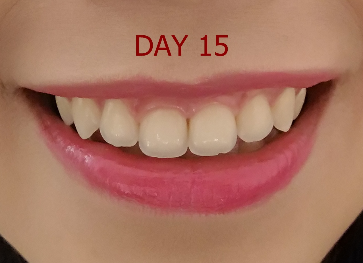 CREST WHITENING STRIPS | AN HONEST REVIEW - MRS. A