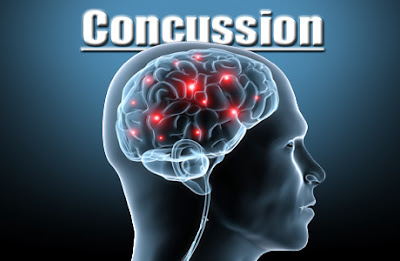 Concussion Information ~ Connecticut College Sports Medicine